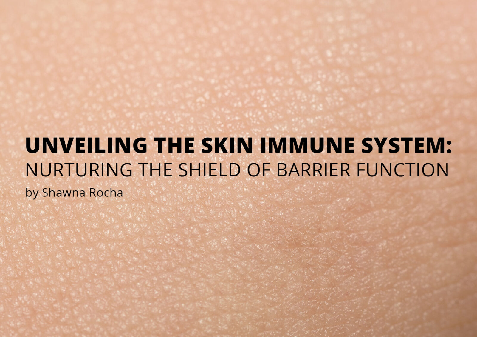 Unveiling the Skin Immune System: Nurturing the Shield of Barrier ...